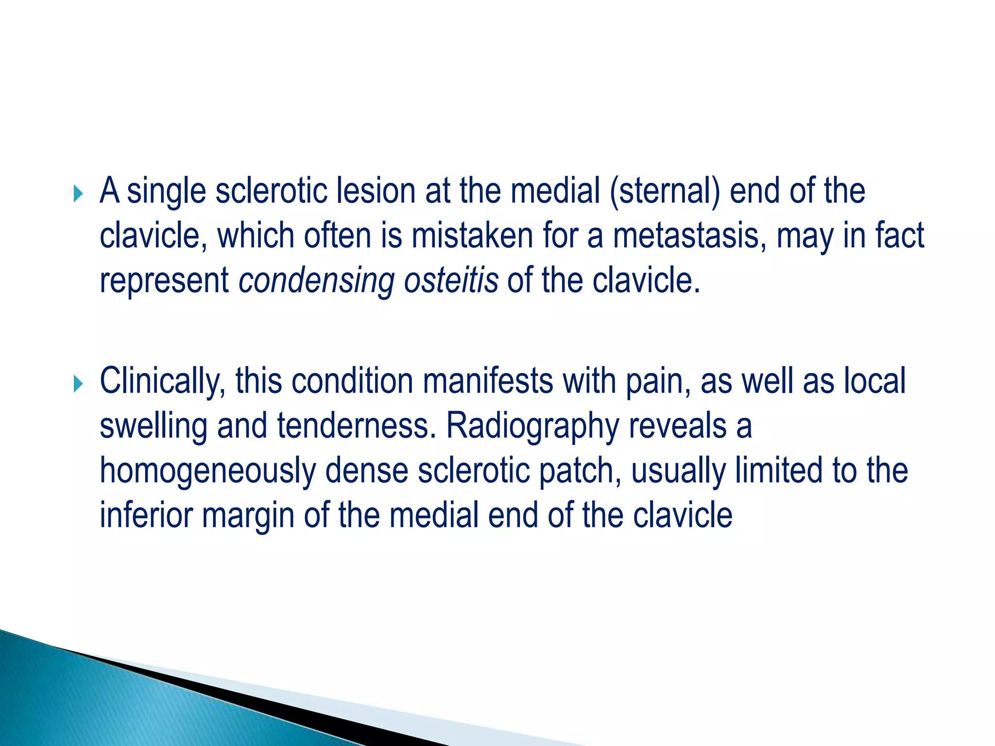 Metastatic bone disease | PPTX
