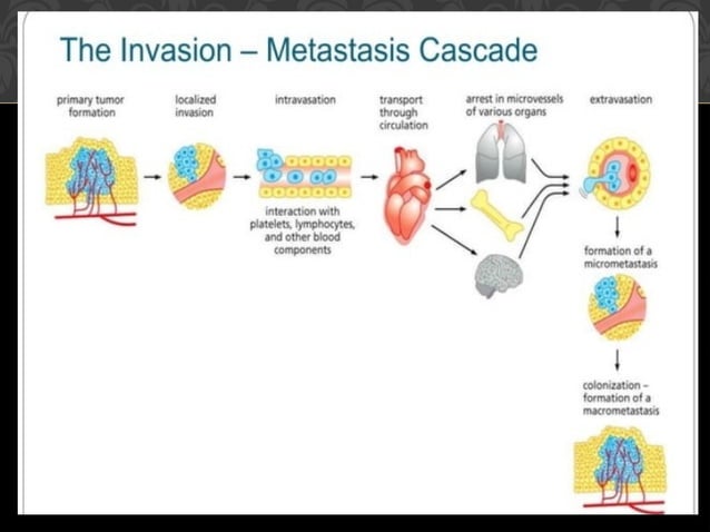 Metastatic cascade DGP. Cancer biology pptx | PPT