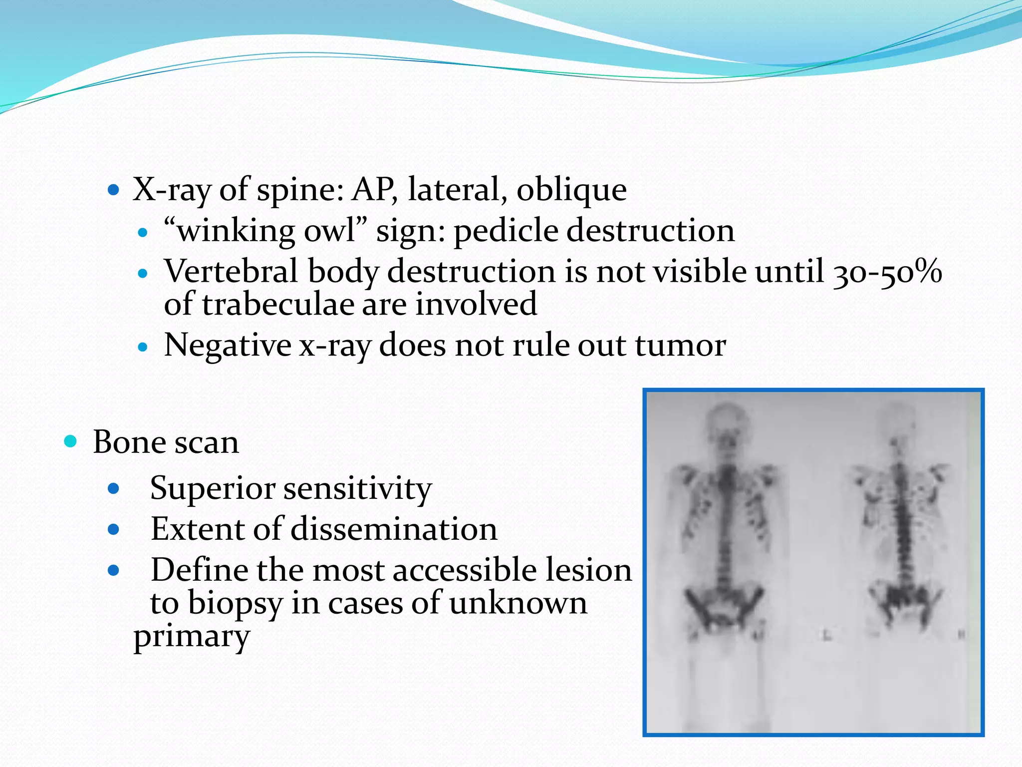 Metastatic diseases of nervous system | PPTX