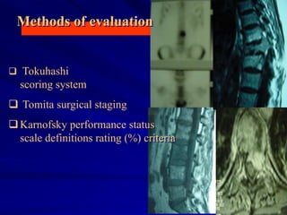 Metastatic Tumors of the Spinal Column | PPT