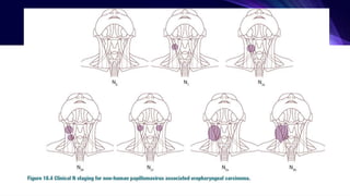 Metastatic neck disease | PPTX