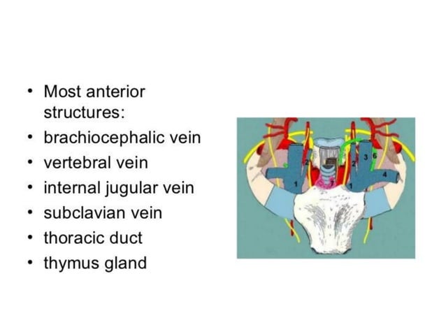 Metastatic neck disease | PPT