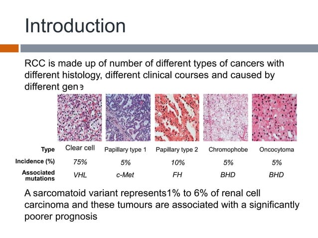 Metastatic renal cell carcinoma | PPTX