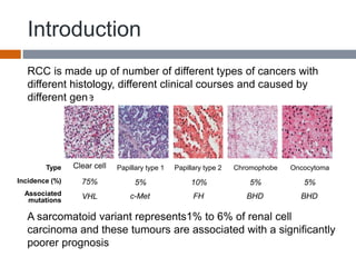 Metastatic renal cell carcinoma | PPT