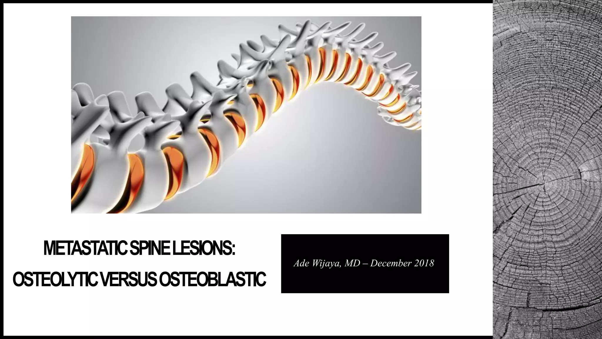 Metastatic Spine Lesions | PPT