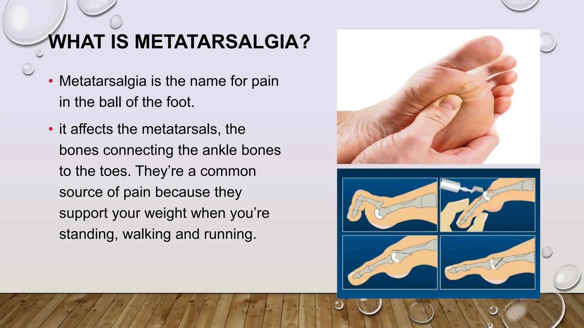 Metatarsalgia.pptx | Foot Health | Diseases and Conditions