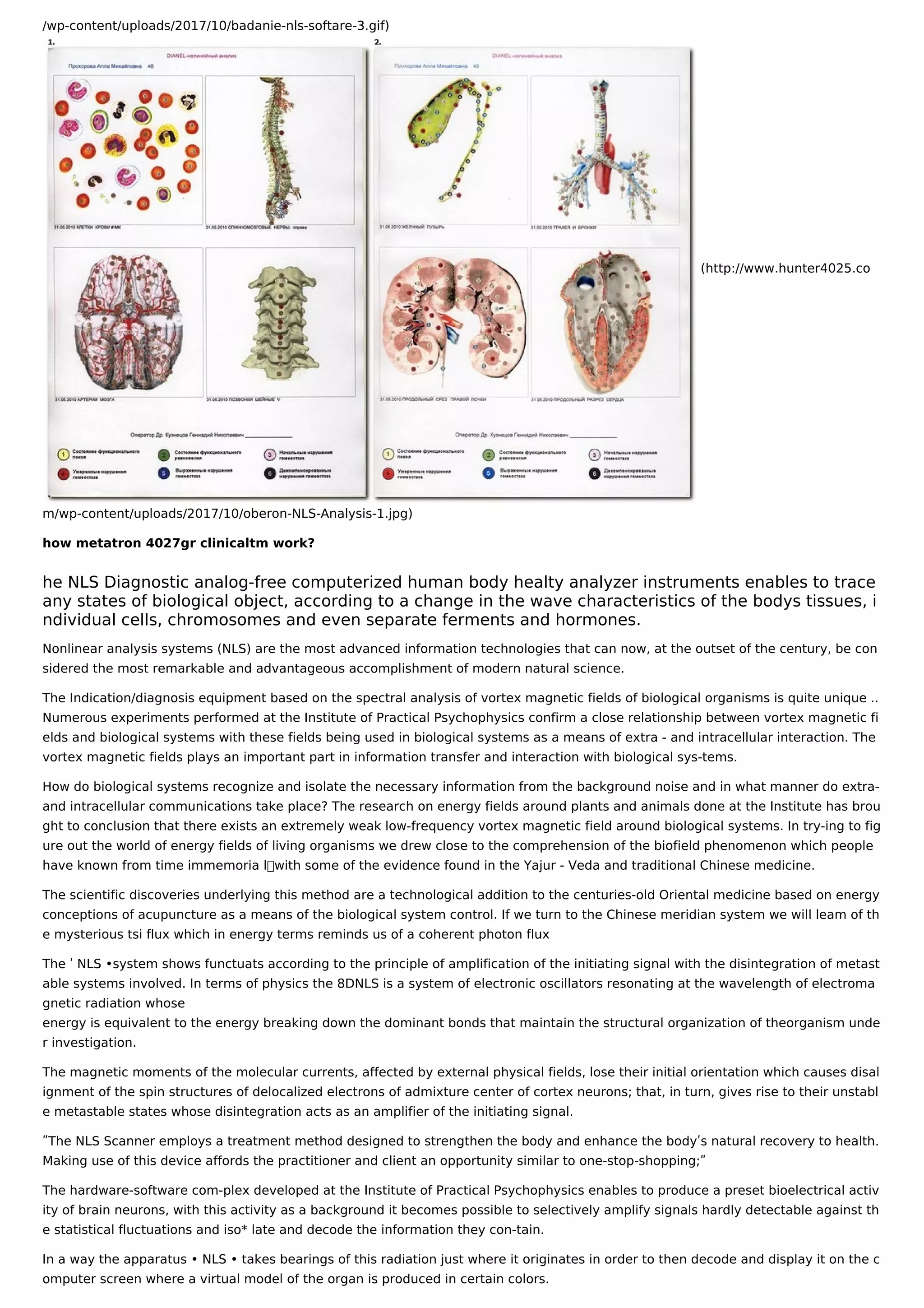 Metatron 4027gr clinicaltm what why it and price | PDF