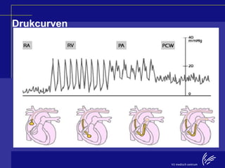 Sessie 3: Meten is weten asthma cardiale en cardiac outputmeting | PPT