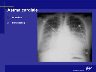 Sessie 3: Meten is weten asthma cardiale en cardiac outputmeting | PPT