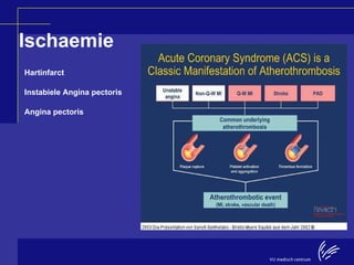 Sessie 3: Meten is weten asthma cardiale en cardiac outputmeting | PPT