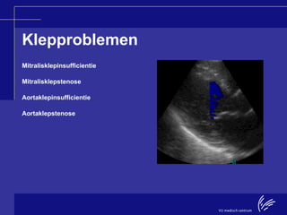 Sessie 3: Meten is weten asthma cardiale en cardiac outputmeting | PPT