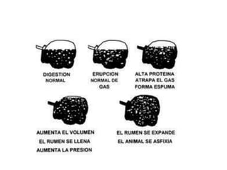 Meteorismo | PPTX