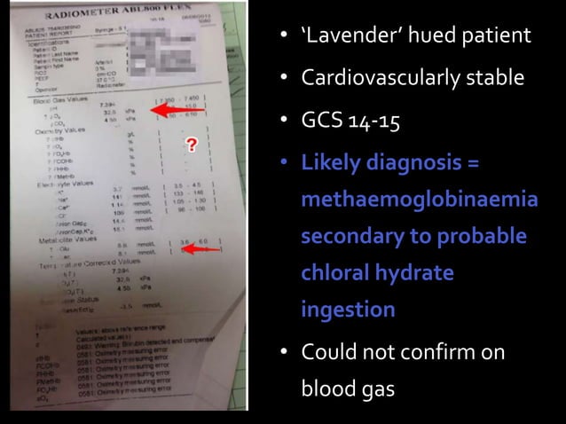 Methaemoglobinaemia a case study | PPT
