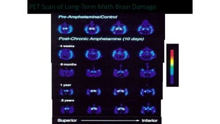 Methamphetamine | PPTX