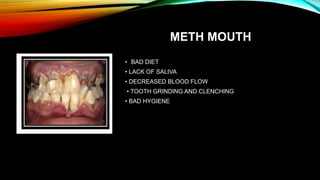 methamphetamine.pptx | Free Download