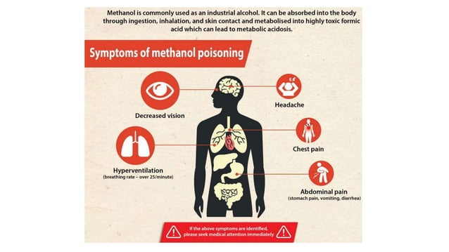 methanol toxicity - Copy.pptx