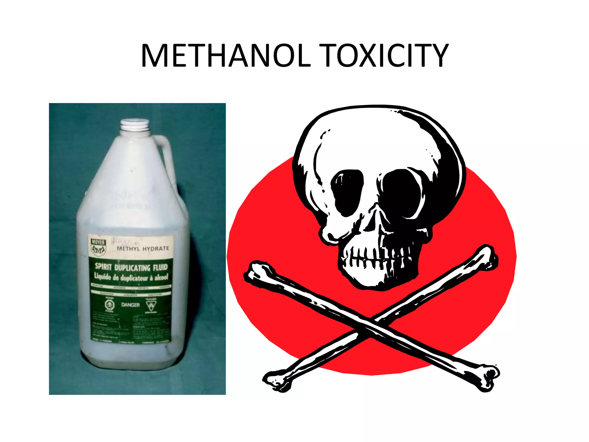 Methanol toxicity | PPT