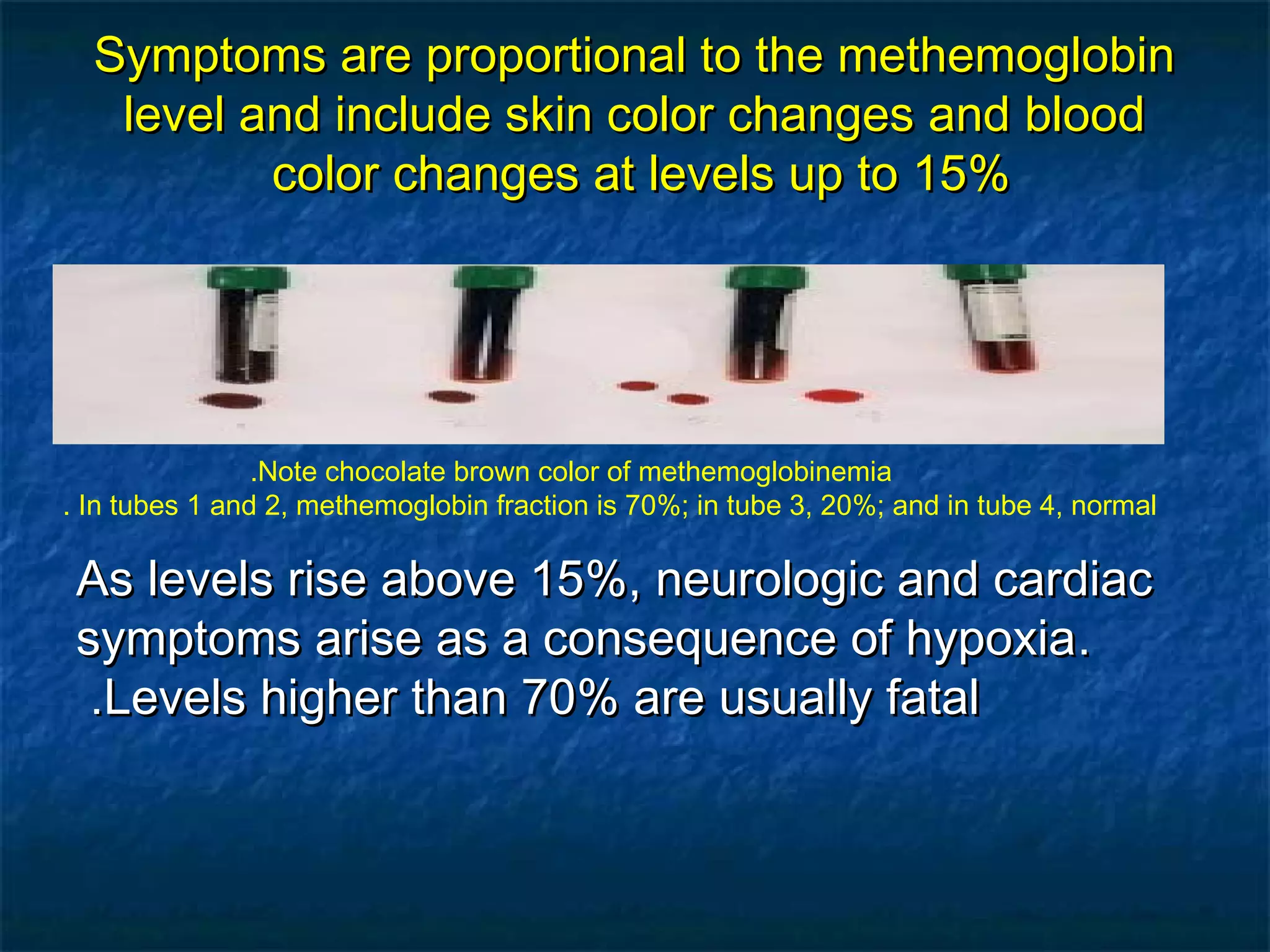 Methemoglobinaemia | PPT