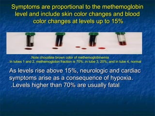 Methemoglobinaemia | PPT