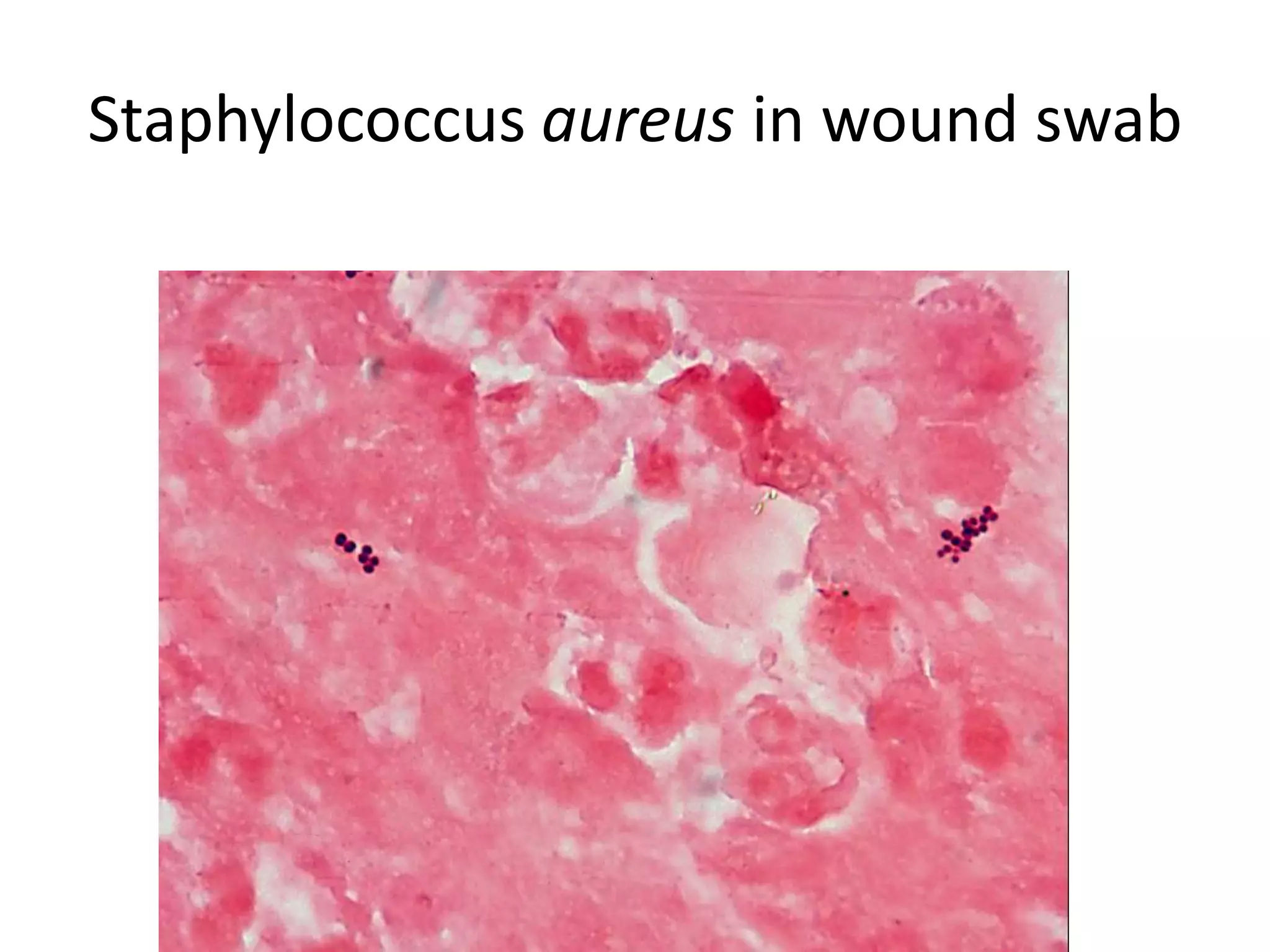 Methicillin Resistant Staphylococcus Aureus Pptx
