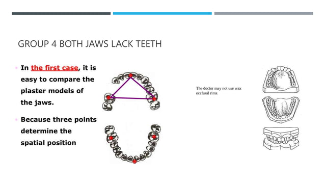 Method for determining central occlusion and central jaw.pptx
