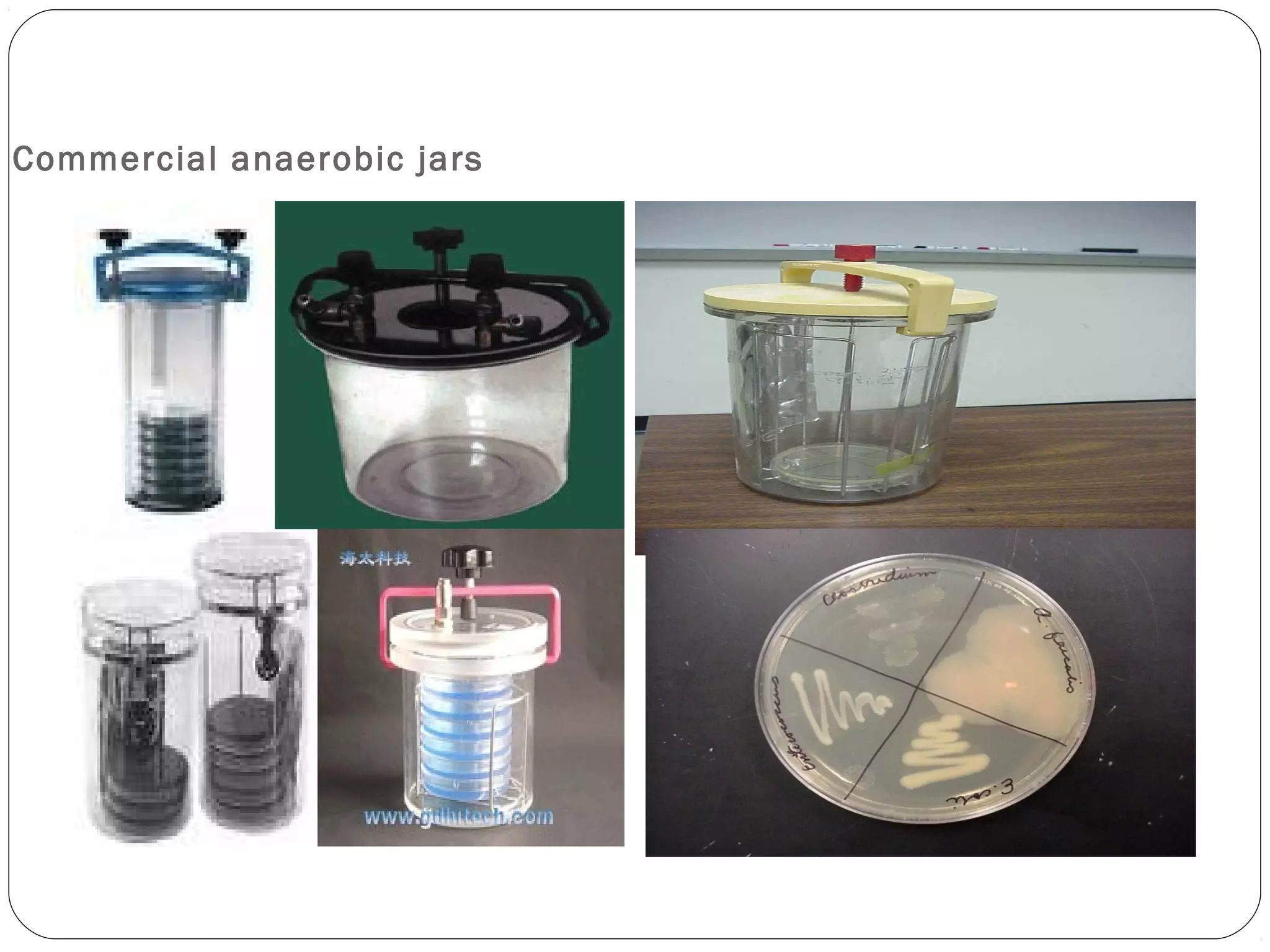 Method of Anaerobiasis and Anaerobic culture | PPT