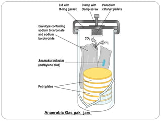 Method of Anaerobiasis and Anaerobic culture | PPT