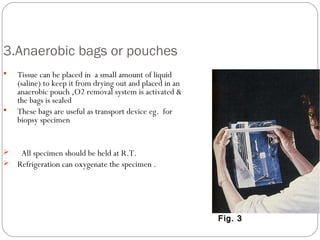 Method of Anaerobiasis and Anaerobic culture | PPT