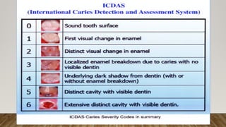 method of caries diagnosis. In dentistry pptx | PPTX