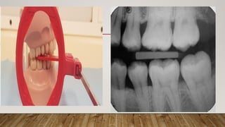 method of caries diagnosis. In dentistry pptx | PPTX