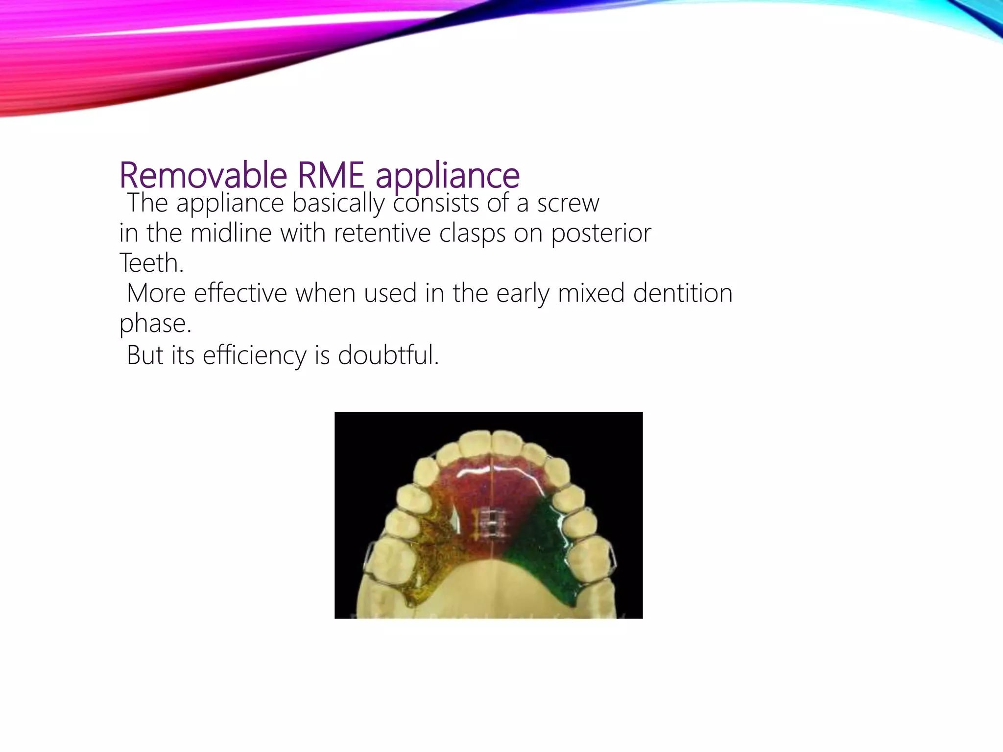 Method of gaining space | PPTX