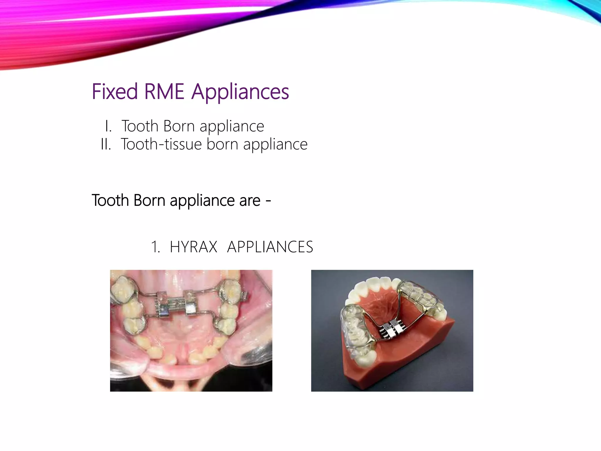 Method of gaining space | PPTX