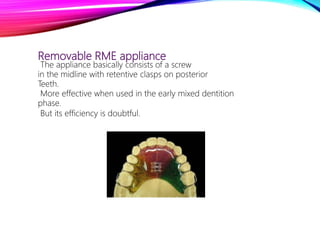 Method of gaining space | PPTX