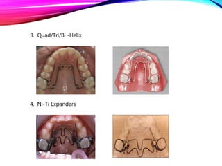 Method of gaining space | PPTX