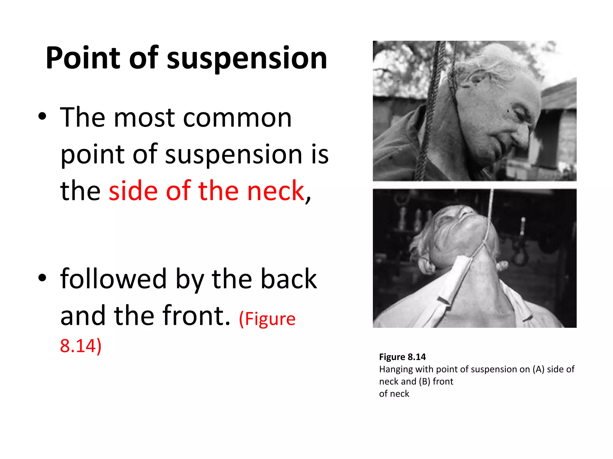 Strangulation (Hanging) | PPTX