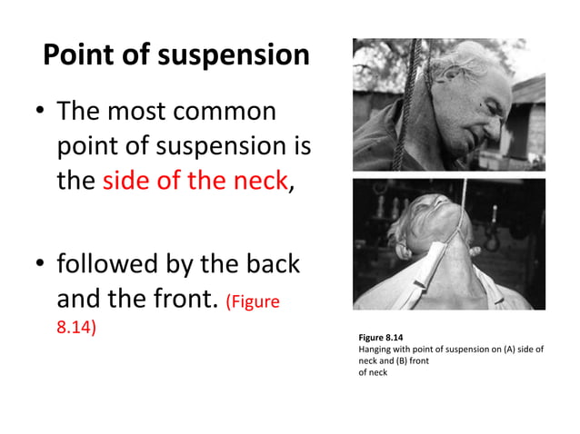 Strangulation (Hanging) | PPTX