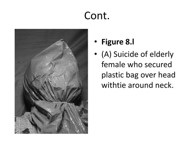 Strangulation (Hanging) | PPTX