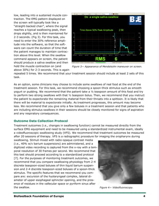 sEMG biofeedback in dysphagia | PDF