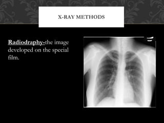Radiological methods to diagnosis.pptx