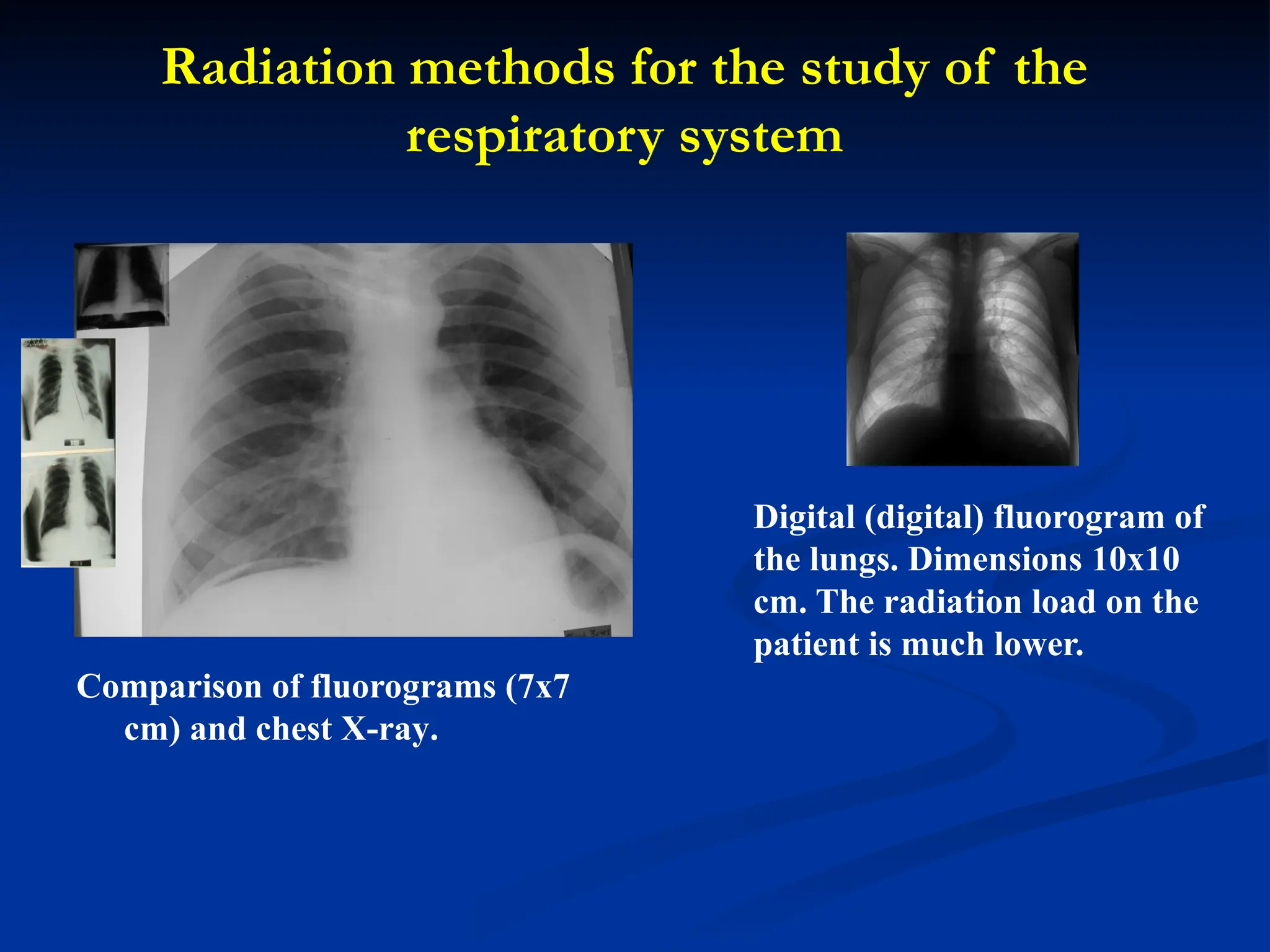 Methods and techniques for radiology diagnostic.pptx