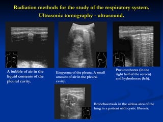 Methods for diagnosis for radiation presentation.ppt