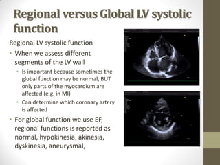 Methods for Assessment of Regional Systolic function_ECHO7.pdf