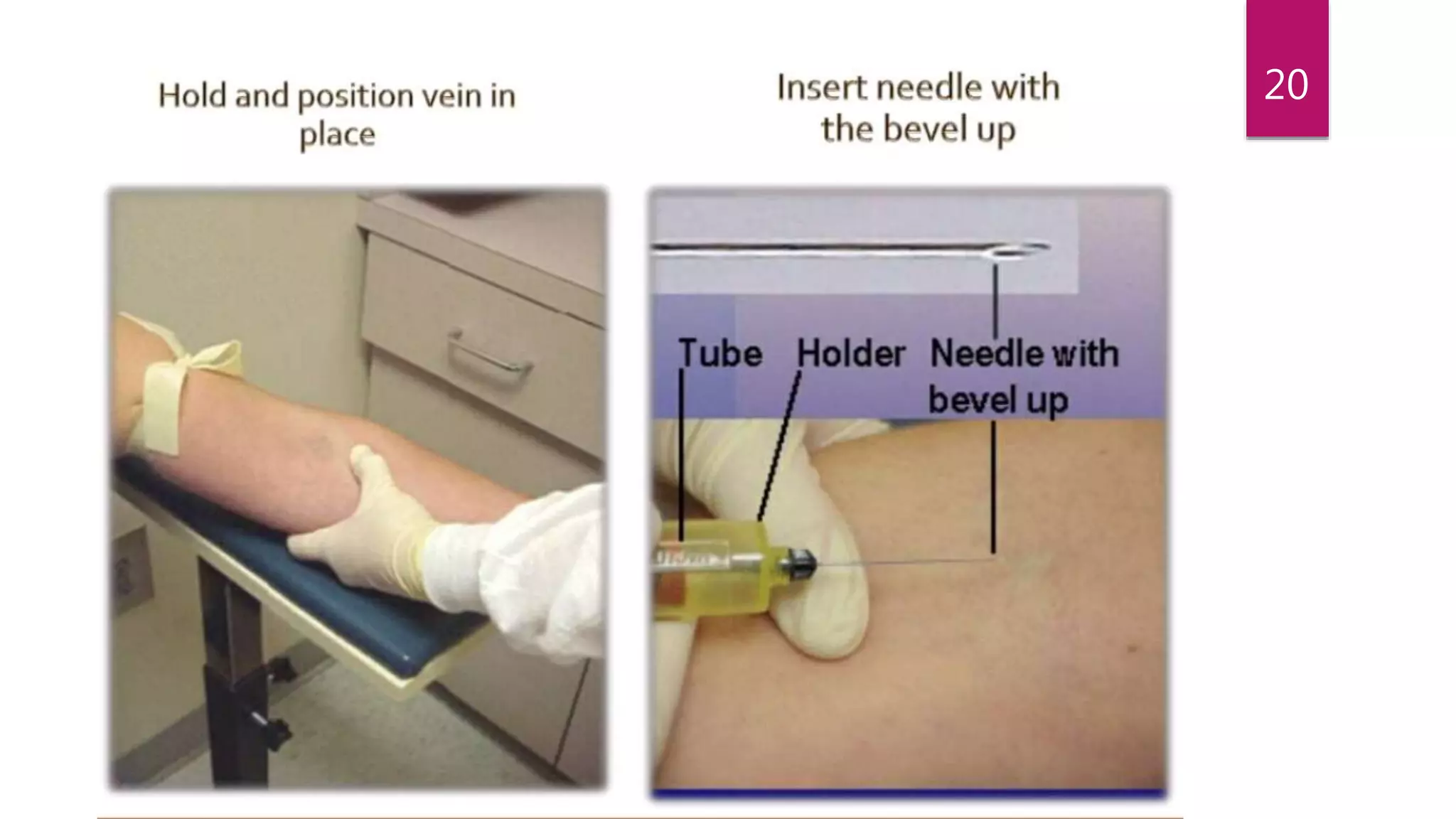 Methods of Blood Collection and Anticoagulants | PPTX