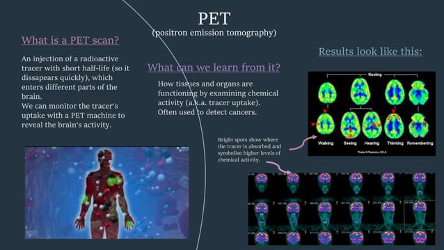 BrainImagingTechniques.pptx