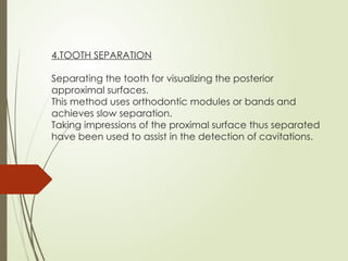METHODS OF CARIES DETECTION paedodontics | PPTX