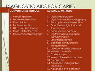 METHODS OF CARIES DETECTION paedodontics | PPTX