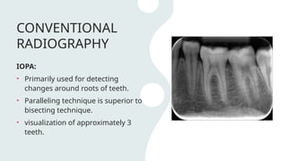 Methods of Caries Detection[1].pptx by jerry | PPTX