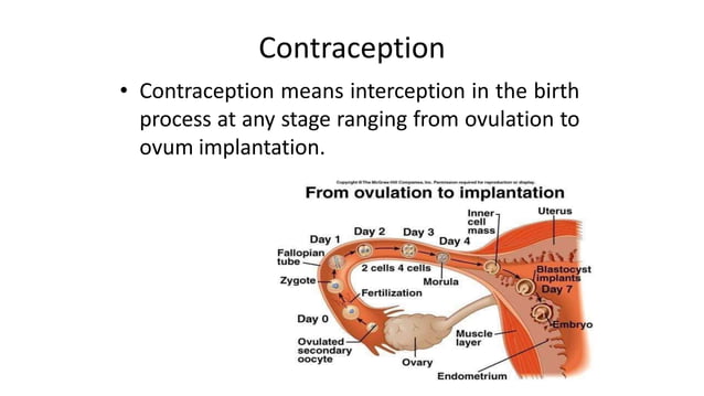 methods of contraception.pptx | Pregnancy | Reproductive Health