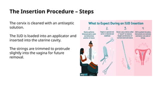 INTRAUTERINE METHODS of contraception -gynaecology | PPTX