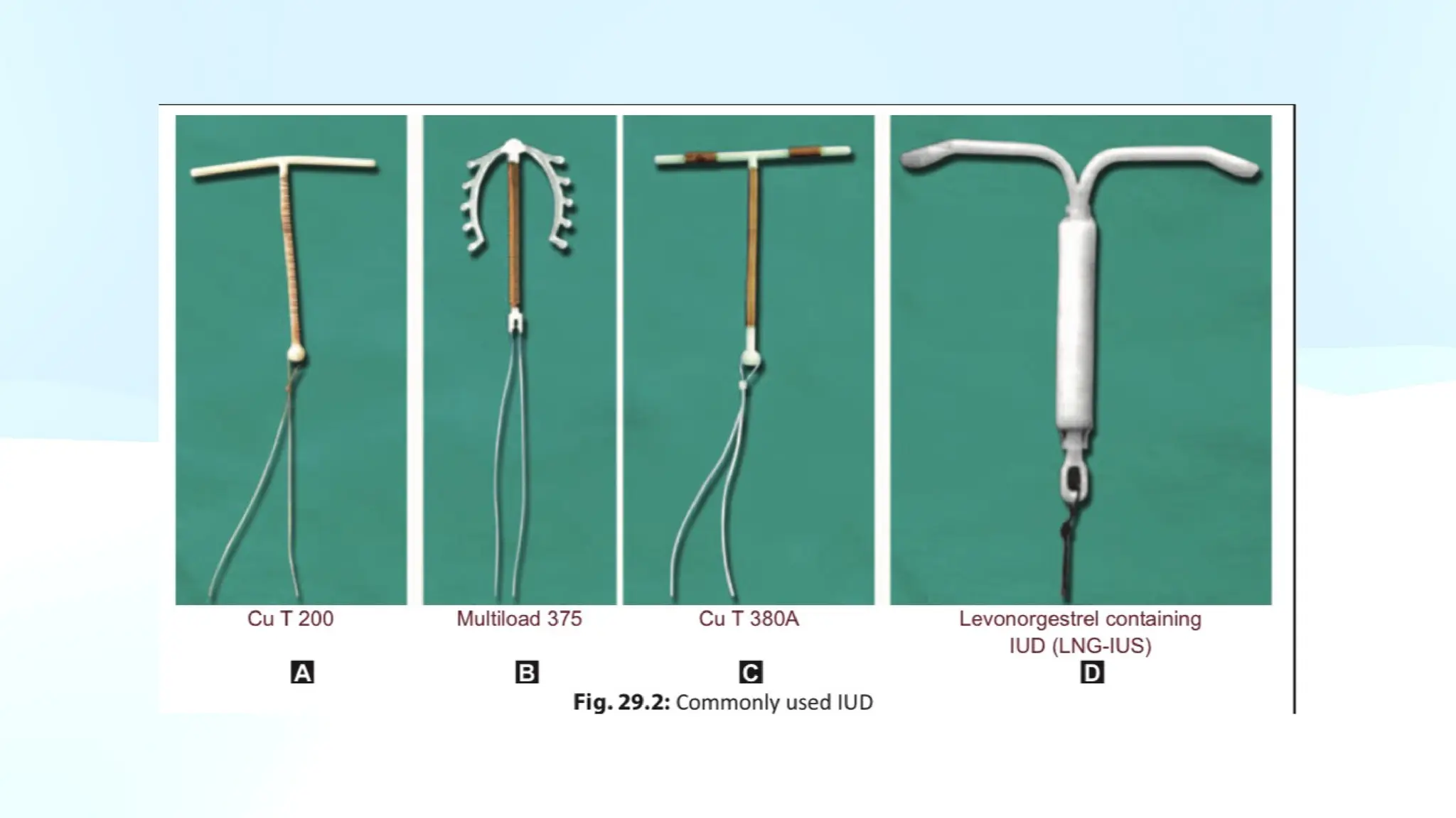 Methods of contraception OBG GYN 2nd year.pptx